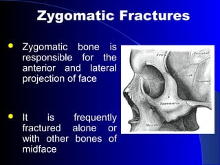 zygomatic reduction,which comes when | PPT