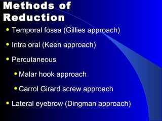 zygomatic reduction,which comes when | PPT