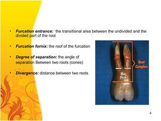 030.furcation involvement and its therapy | PPT