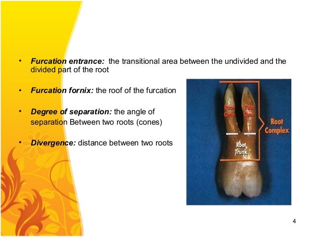 030.furcation involvement and its therapy