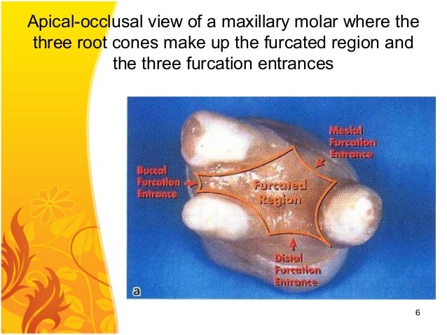 030.furcation involvement and its therapy
