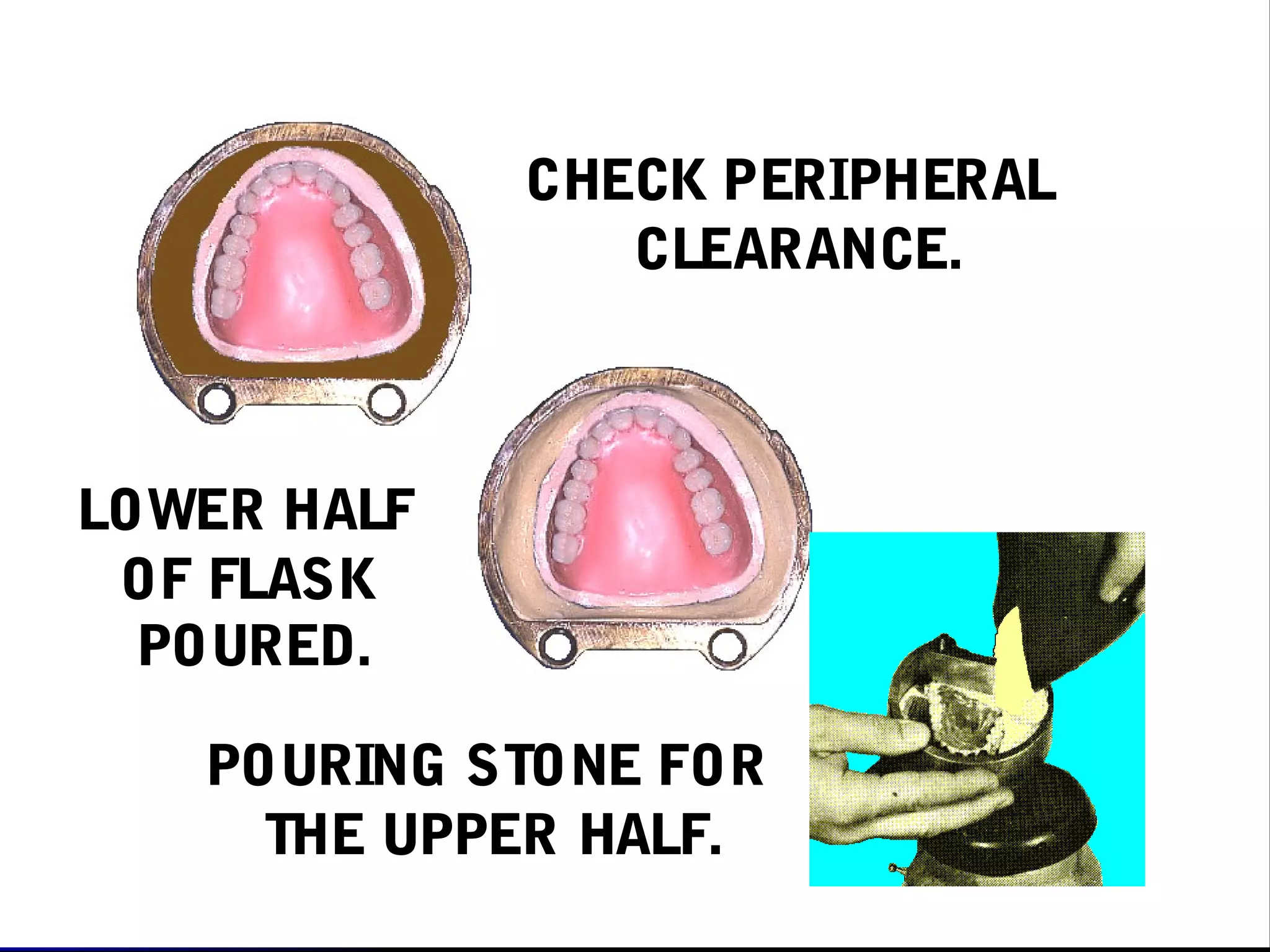 03 01 01_45-(flasking and processing complete denture) | PPT