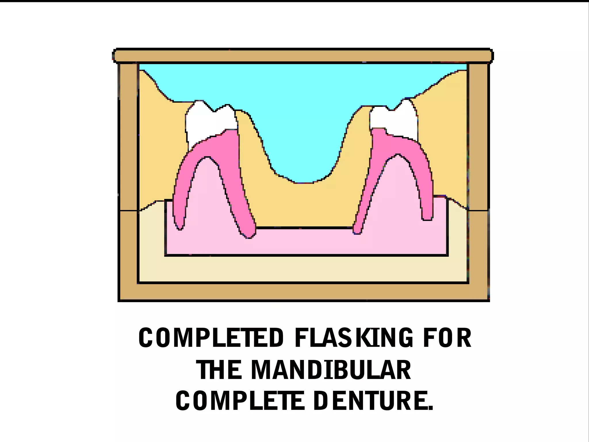 03 01 01_45-(flasking and processing complete denture) | PPT