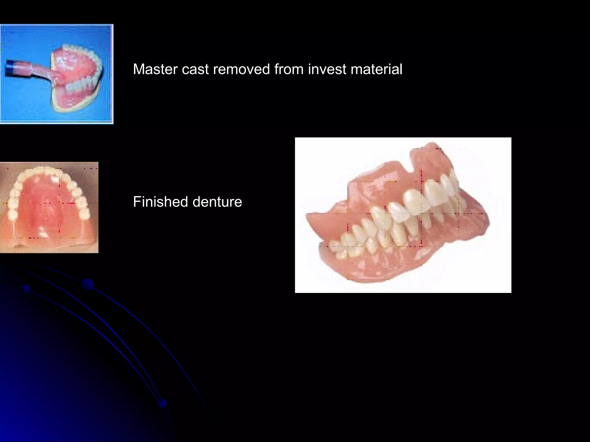 03 01 01_45-(flasking and processing complete denture) | PPT