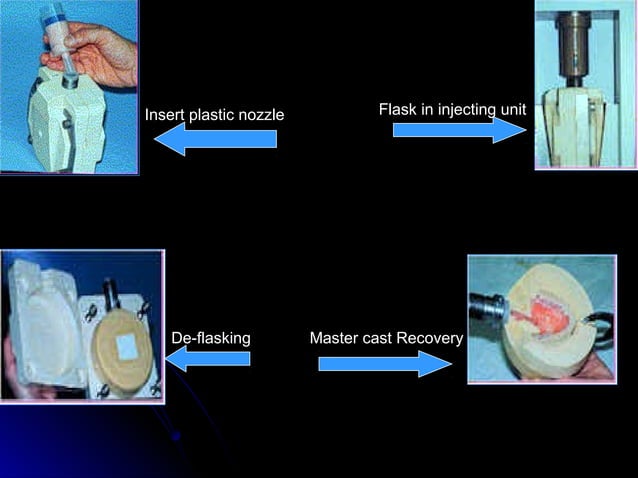 03 01 01_45-(flasking and processing complete denture) | PPT | Dental ...