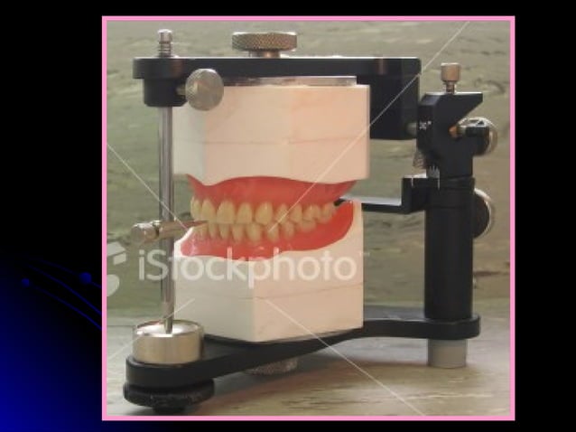 03 01 01_45-(flasking and processing complete denture) | PPT | Dental ...