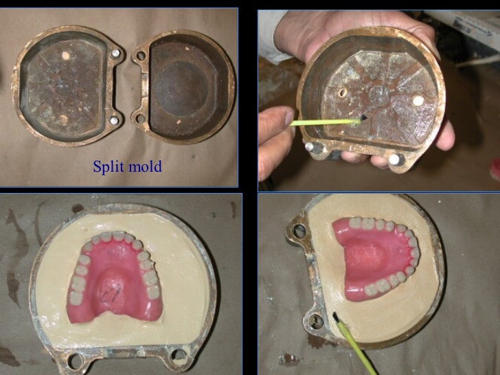 03 01 01_45-(flasking and processing complete denture)