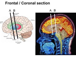 030915 overview gross neuroanatomy student | PPTX