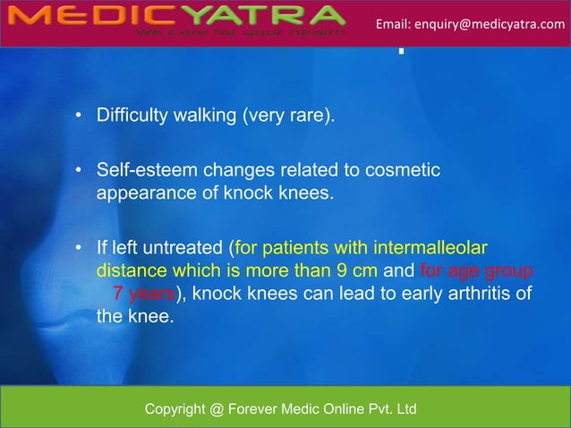 Genu Valgum Treatment & Surgery | PPTX