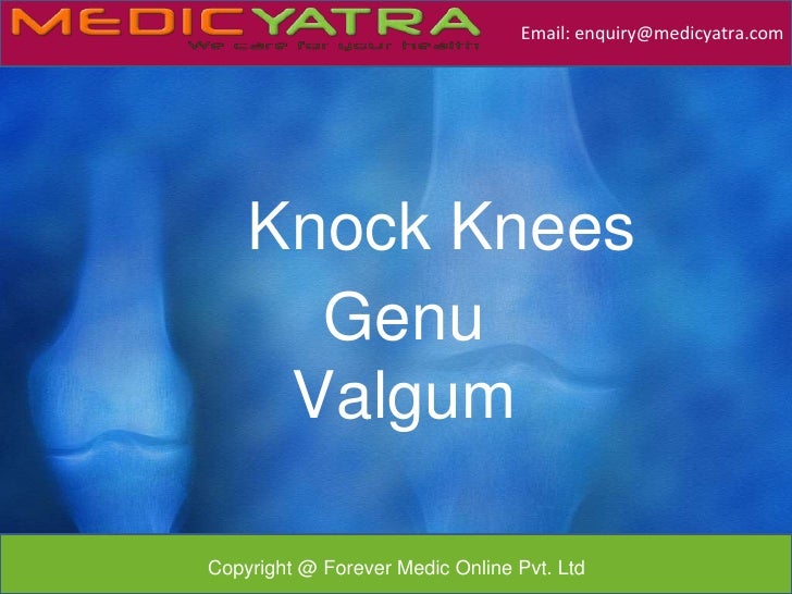 Genu Valgum Treatment And Surgery