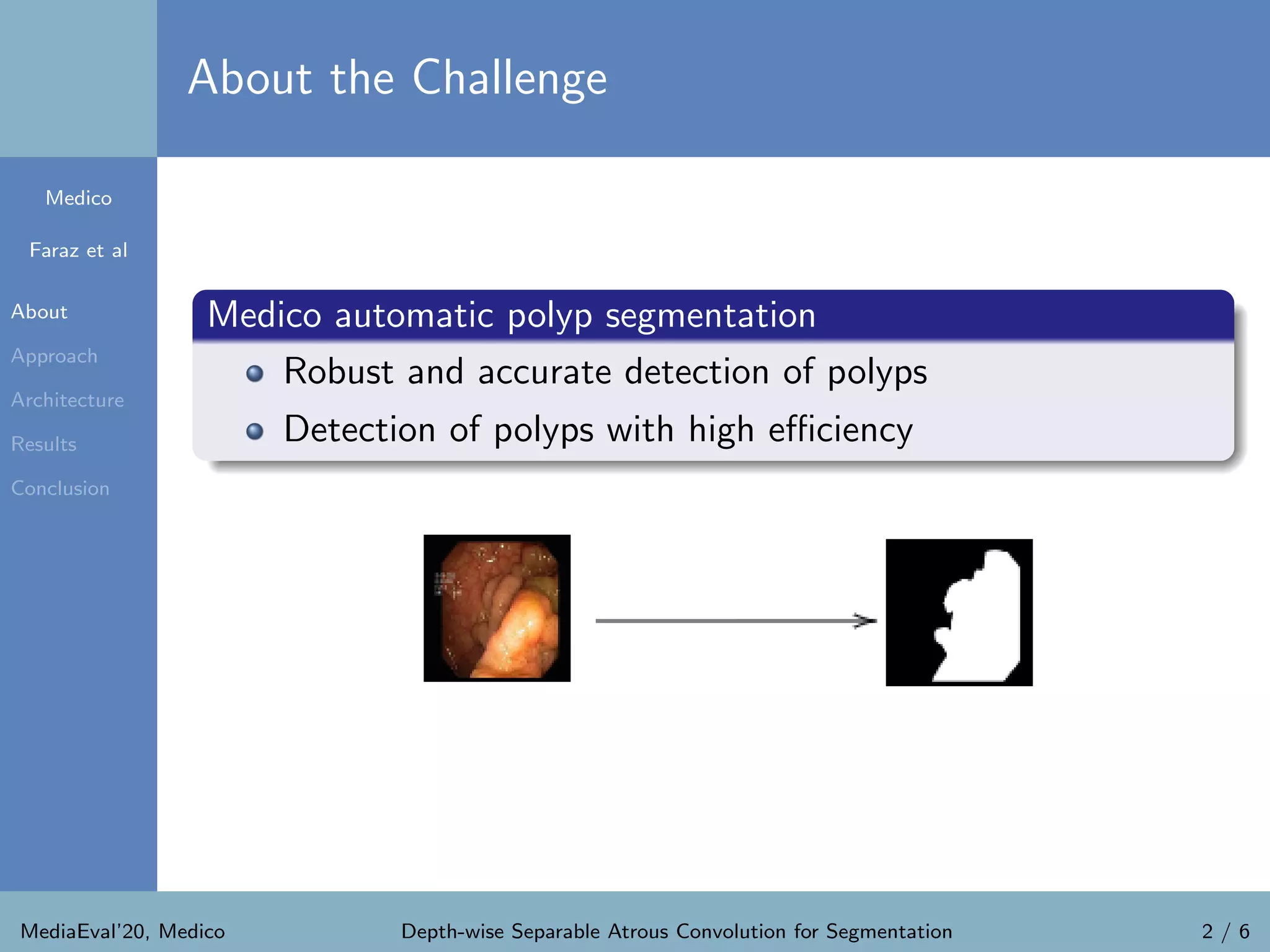 Depth-wise Separable Atrous Convolution for Polyps Segmentation in ...