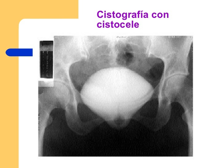 031106 salut urologica 2