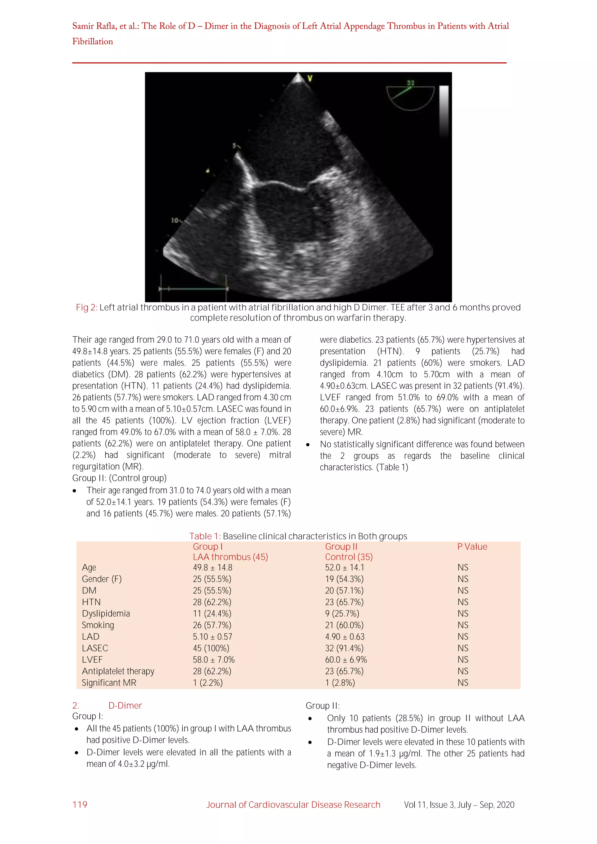 The role of d dimer in the diagnosis of left atrial appendage thrombus . jcdr | PDF