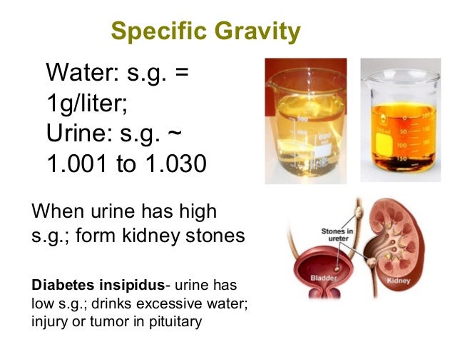 Normal urine specific gravity - herykite