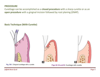 033.gingival curettage | PDF