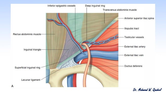 HERNIAS abdominal wall.pdf types diagnosis | PPT