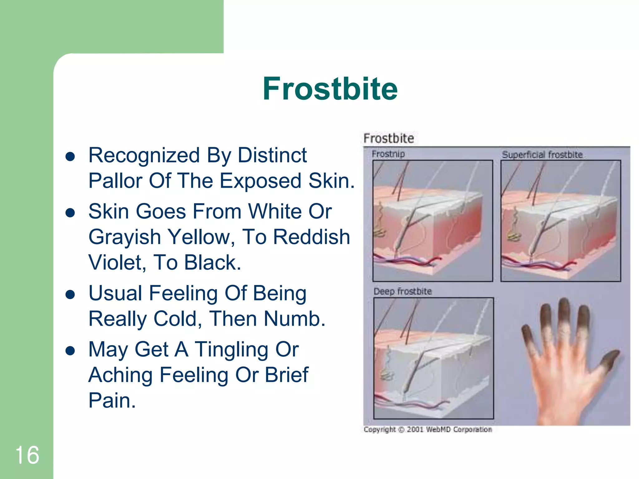 034 Cold Stress.ppt