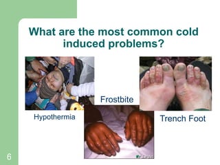 034 Cold Stress.ppt