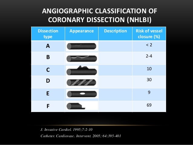 Гончаров — Случаи диссекций коронарных артерий при плановом стентиров…