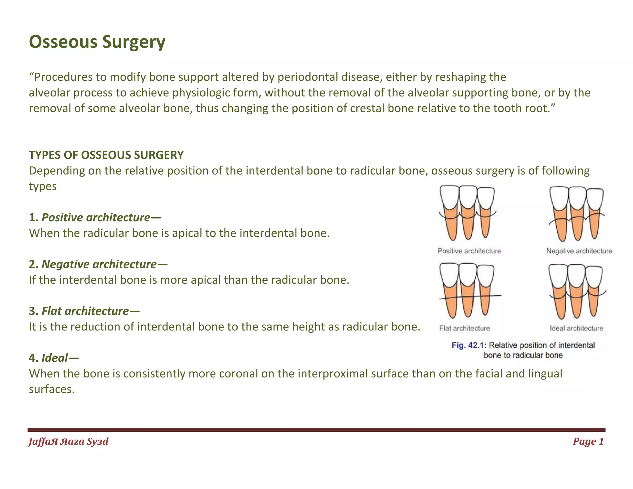 037. osseous surgery | PDF
