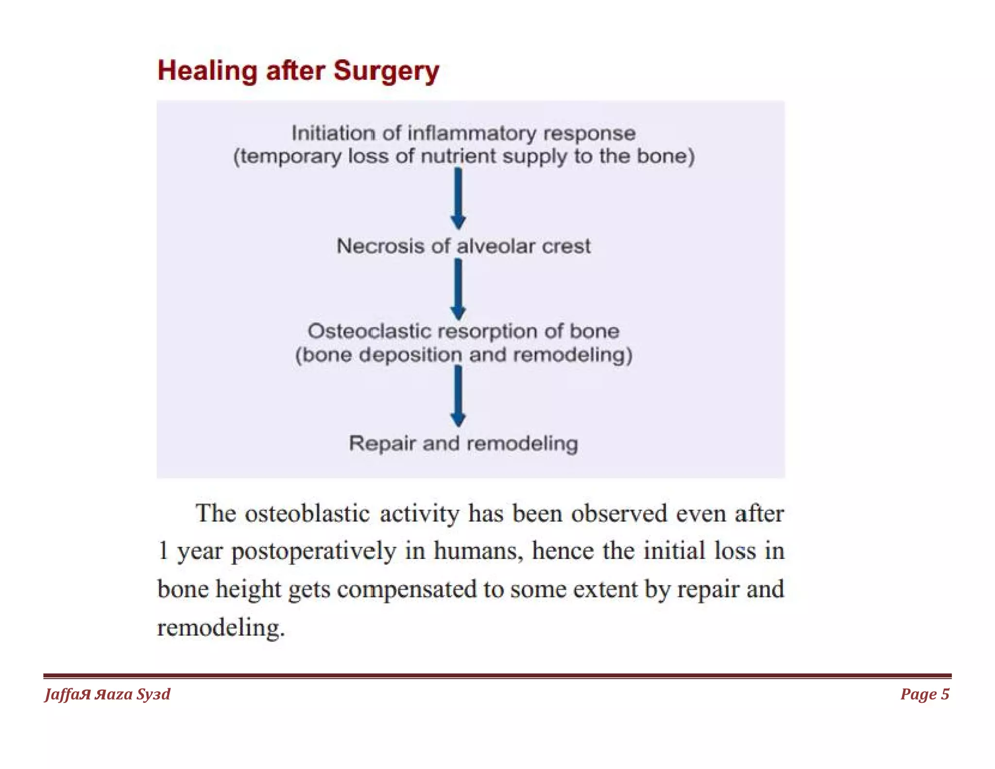 037. osseous surgery | PDF