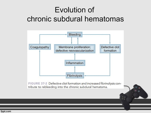 037 Pathophysiology of subdural hematoma | PPT | Blood Disorders ...