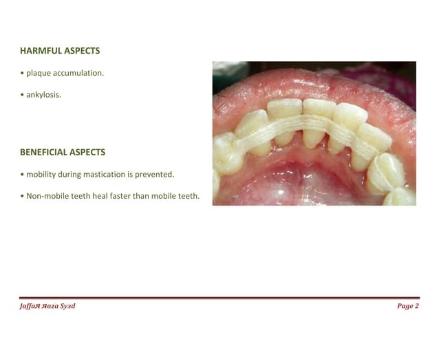 039.splints in periodontal therapy | PDF | Physical Therapy | Wellness