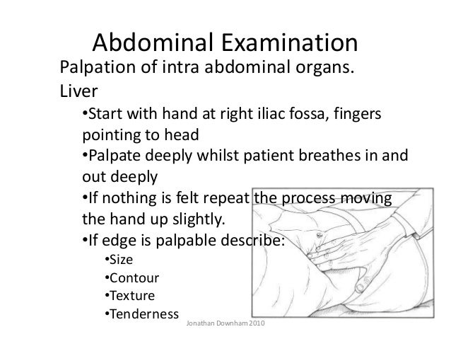 abdominal examination