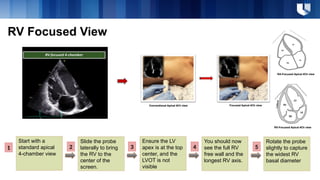 2025 ASE Right Heart and PH Guidelines (Cardiac Imaging Symposium) | PPTX