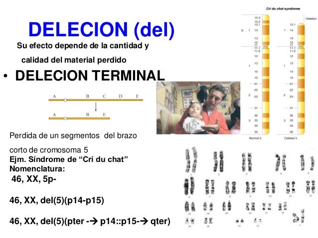 03 alteraciones cromosómicas estructurales