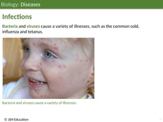 JSH03B044 Diseases; Biology Education ages 11-14 | PPTX