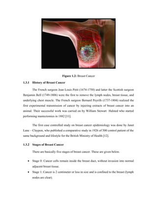ROLL OF POSITRON EMMISION MAMMOGHRAPHY IN DETECTION OF BREAST CANCER ...