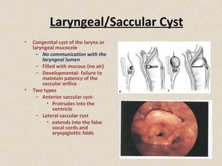 Saccular Cyst