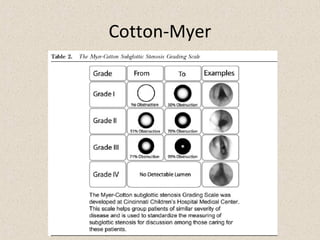 03 benign disease of larynx | PPT