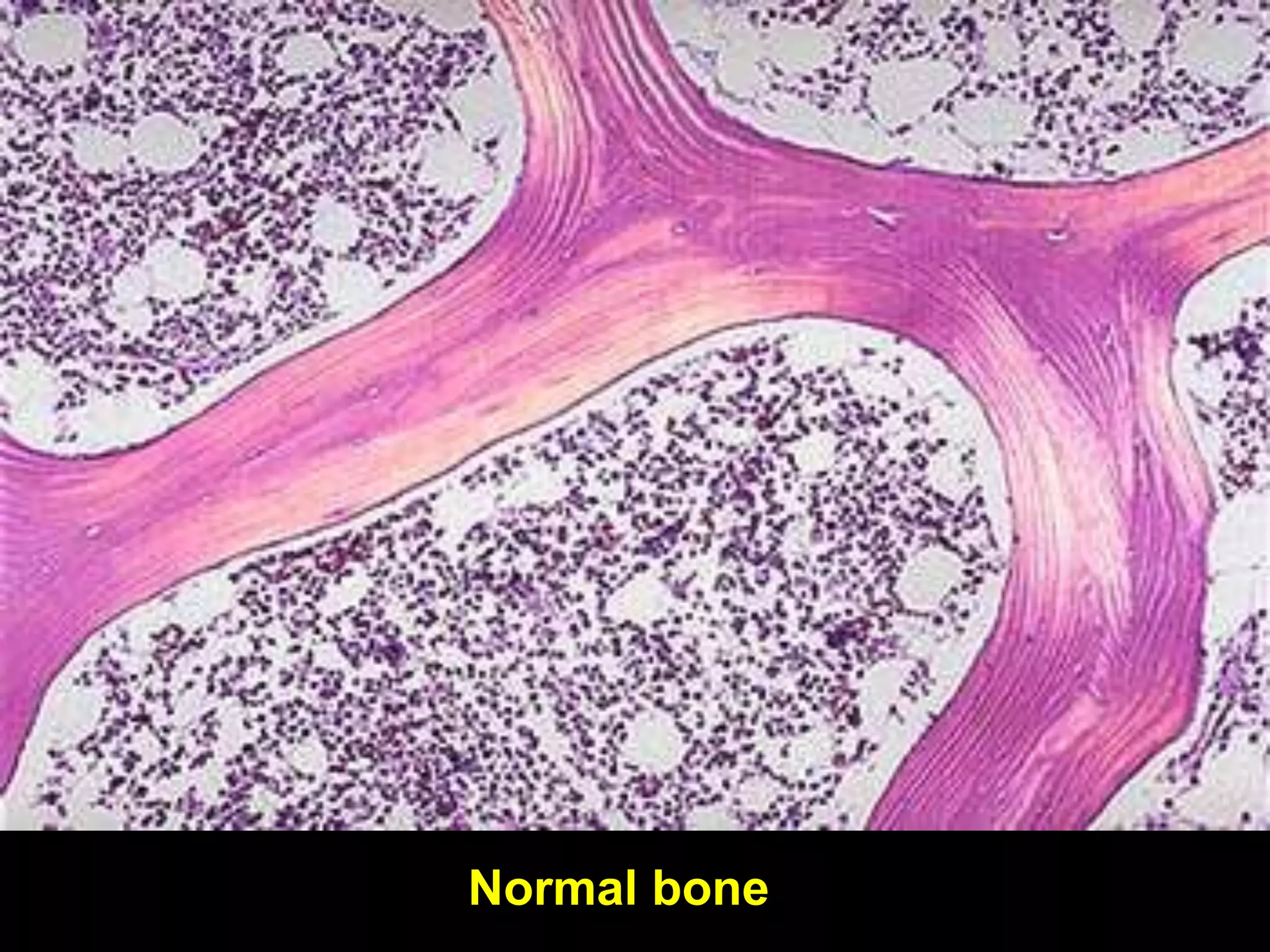 03 bone non neoplastic part-1 | PPT