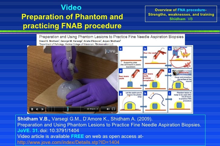 Overview of FNA procedure- S. K. Navale Medical College, Pune, India