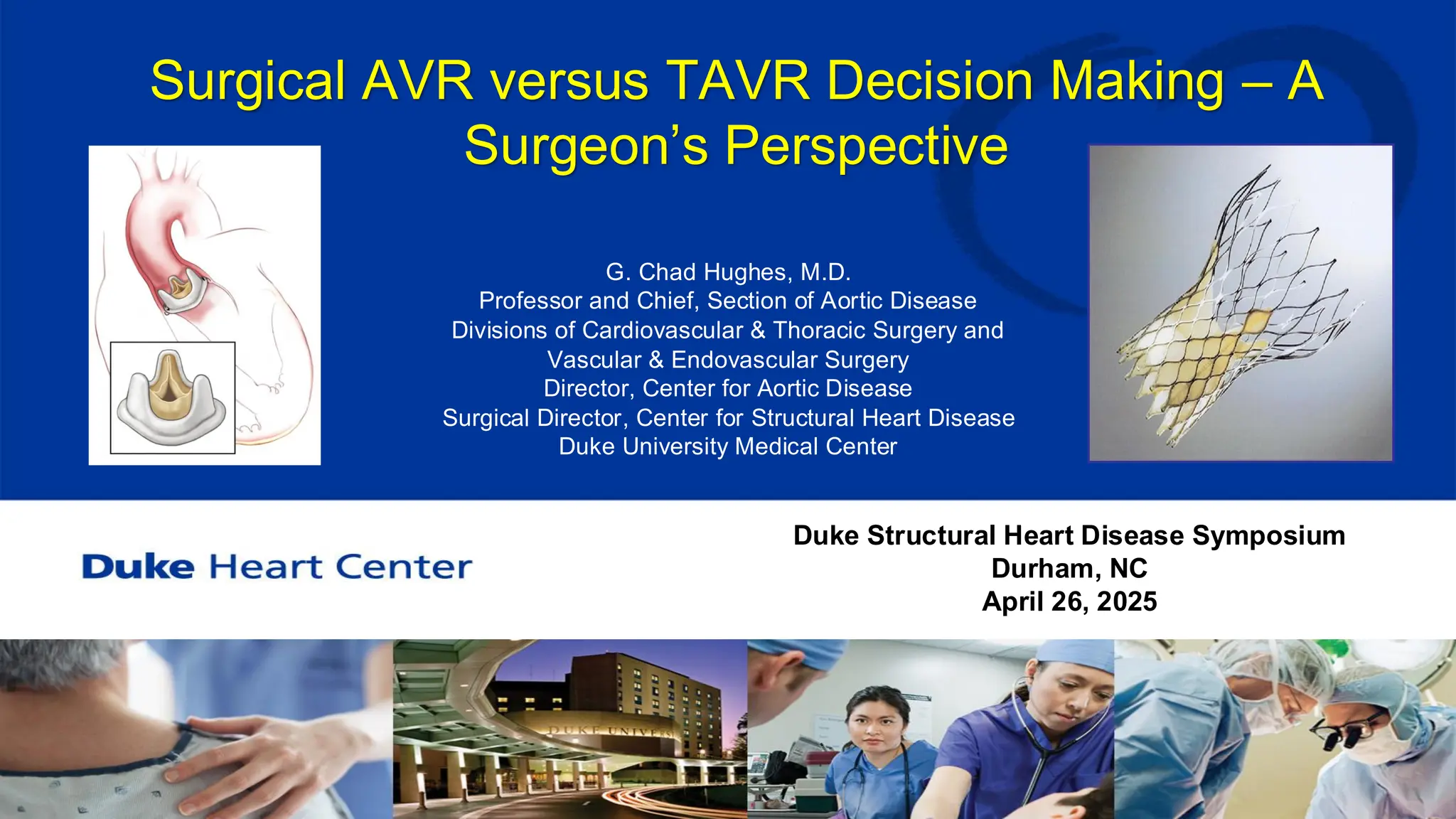 Surgical AVR vs. TAVR Decision Making - A Surgeon's Perspective | PDF