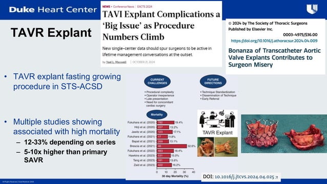 Surgical AVR vs. TAVR Decision Making - A Surgeon's Perspective | PDF