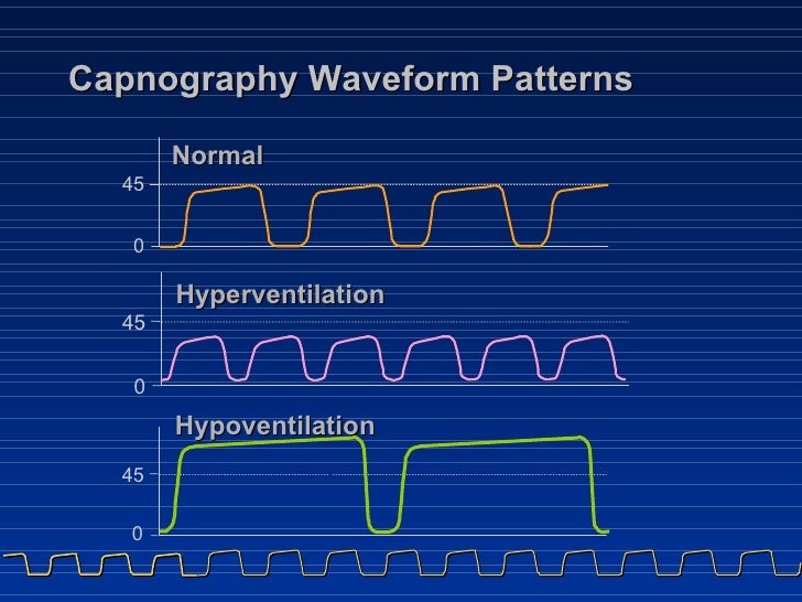 03 capnography