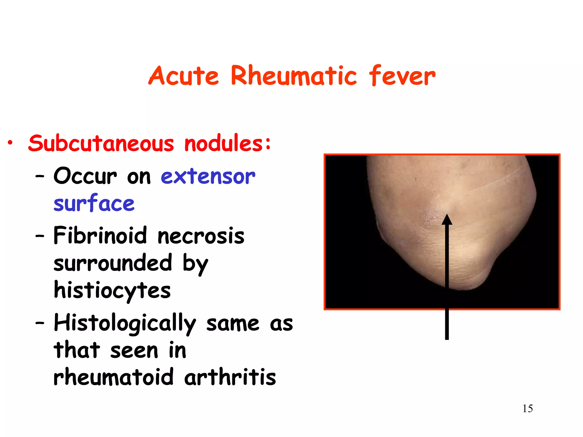 03 cardiac pathology | PPT