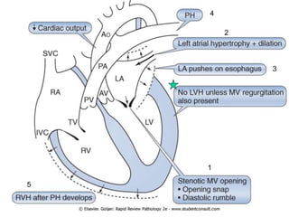 03 cardiac pathology | PPT
