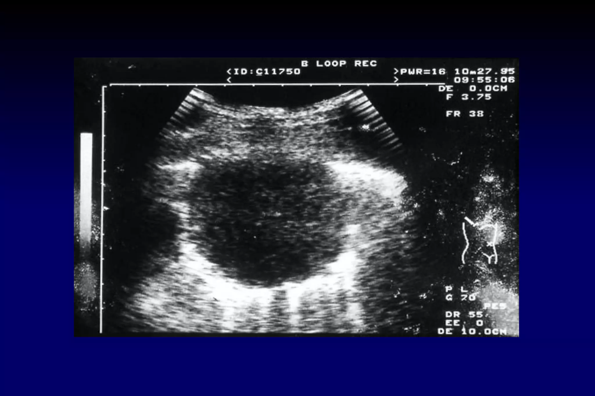 03 chest ultrasound | PDF