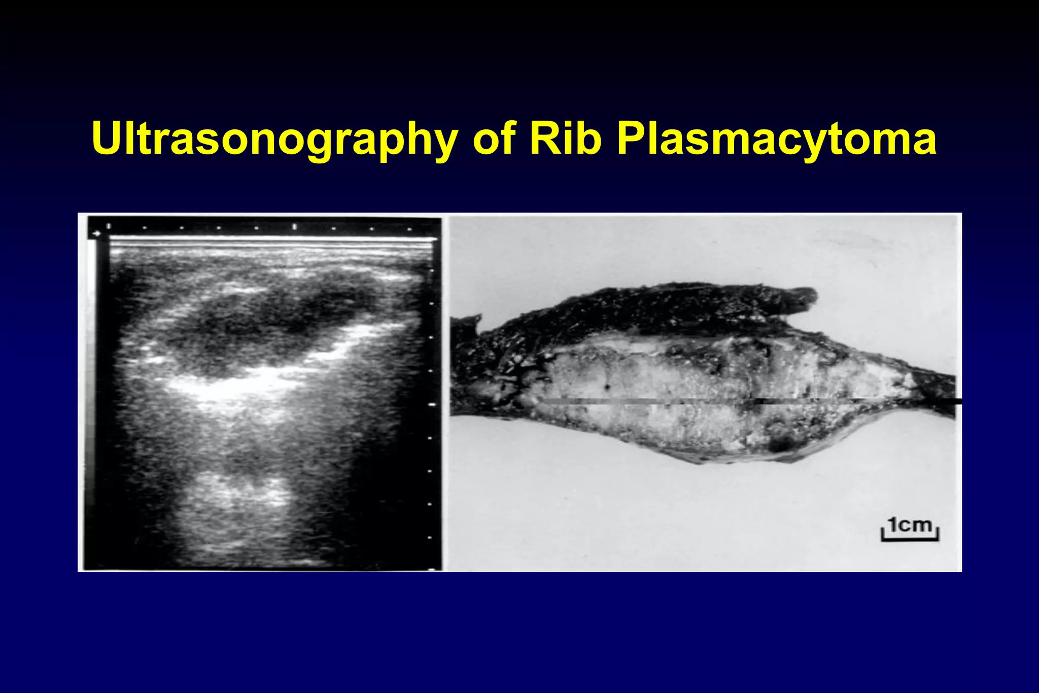 03 chest ultrasound | PPT