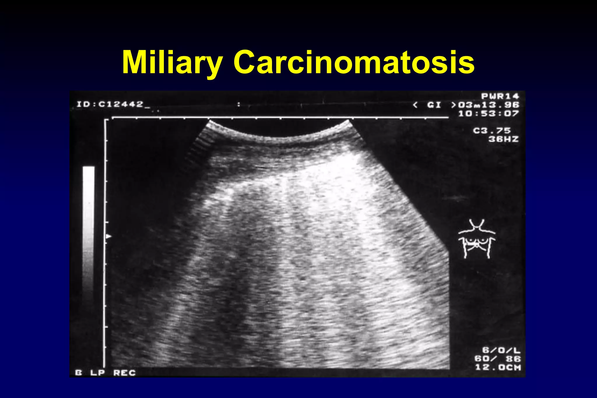 03 chest ultrasound | PPT