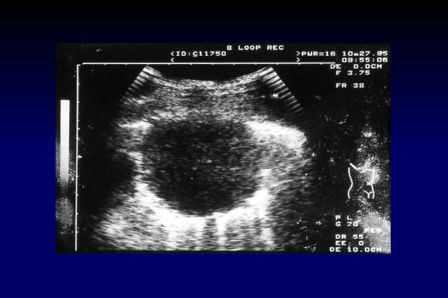 03 chest ultrasound | PPT