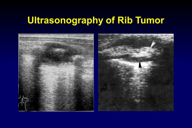 03 chest ultrasound | PPT