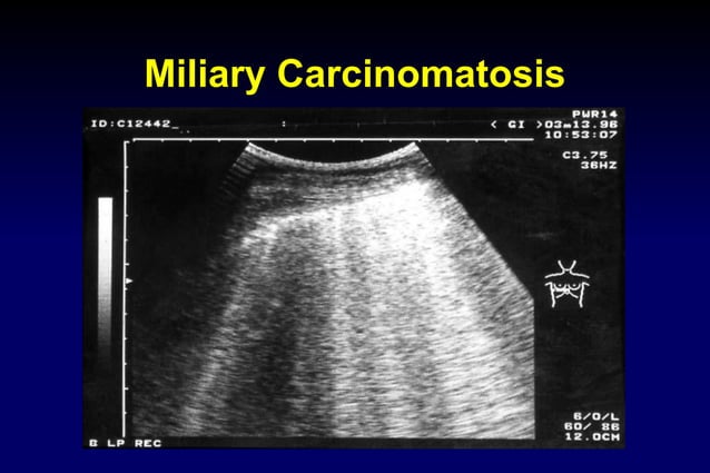 03 chest ultrasound | PPT