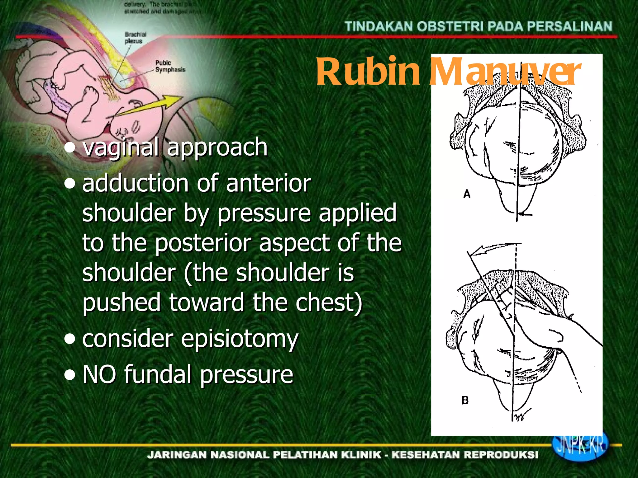 03 distosia bahu | PPT