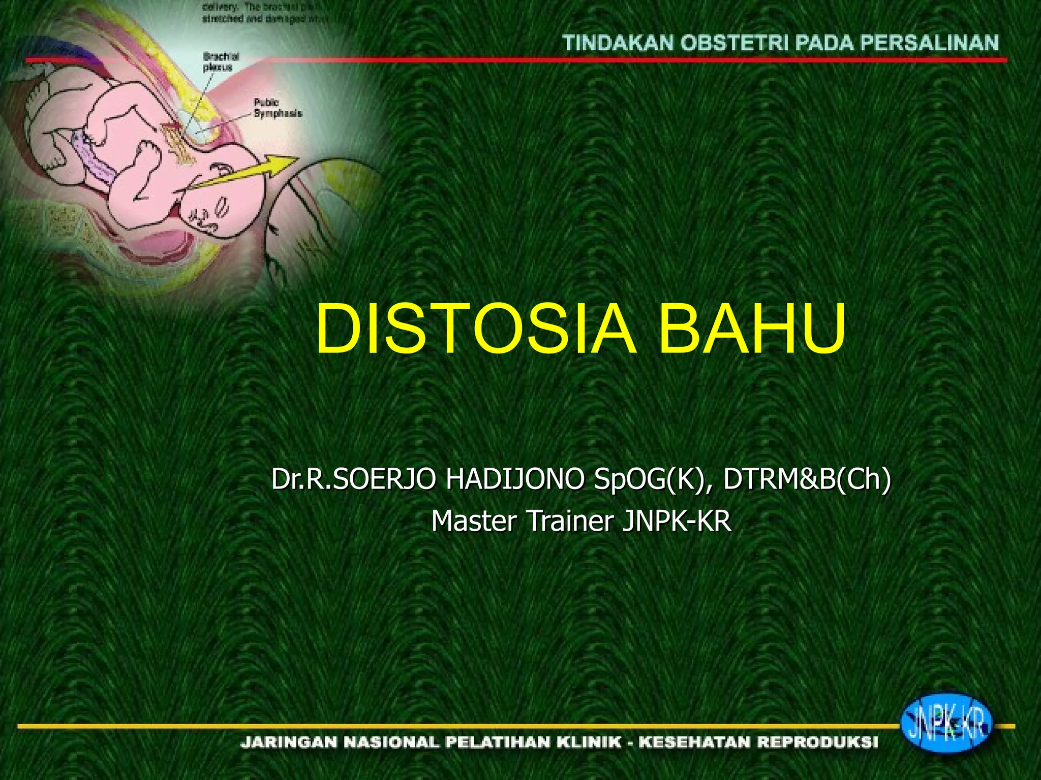 03 distosia bahu | PPT