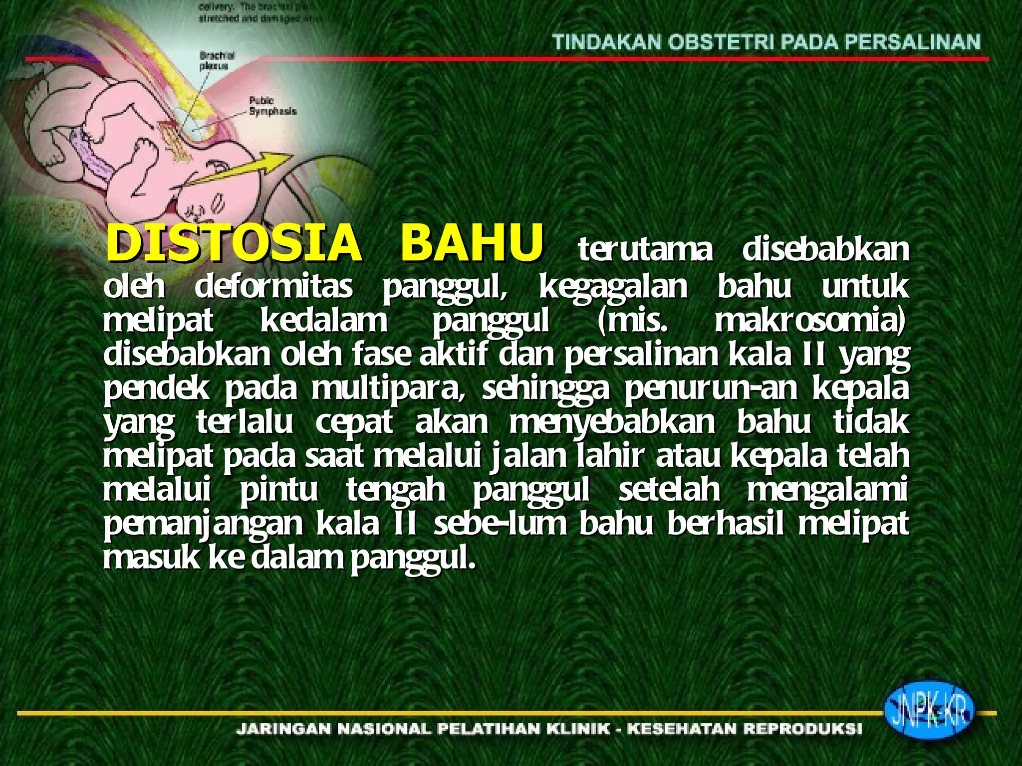03 distosia bahu | PPT